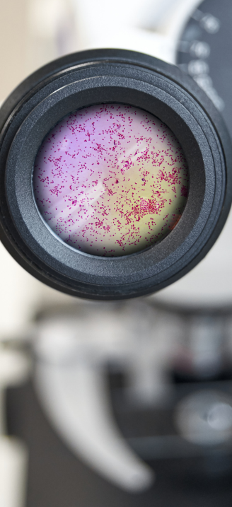 GONOCOQUE (NEISSERIA GONORRHOEAE) - B2A