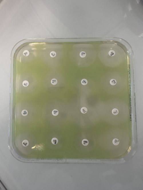 LE TEST RESPIRATOIRE À L'URÉE (HELIKIT®, HELICOBACTER TEST INFAI®) - B2A